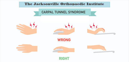 Carpal Tunnel Syndrome Exercises by JOI Rehab Clinicians