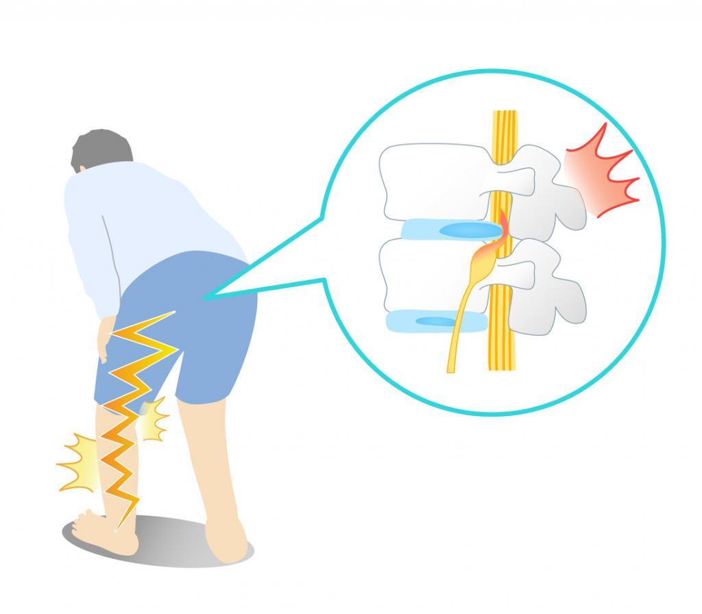 Lifting And Bending Properly - Jacksonville Orthopaedic Institute
