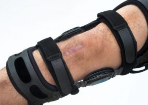 Durable Medical Equipment & Braces