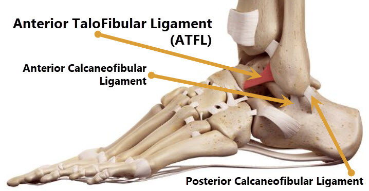 Ligaments Of The Foot - JOI Jacksonville Orthopaedic Institute