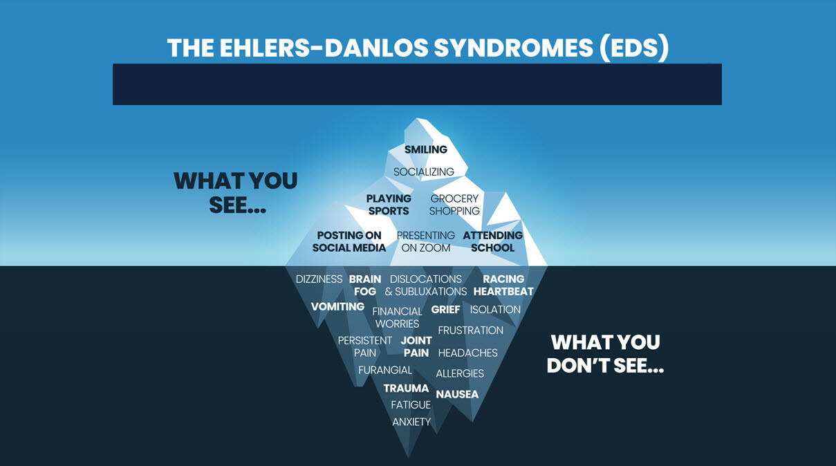 Ehlers-Danlos Syndrome or EDS - JOI & JOI Rehab