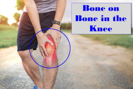 Bone on Bone In The Knee - JOI Jacksonville Orthopaedic Institute
