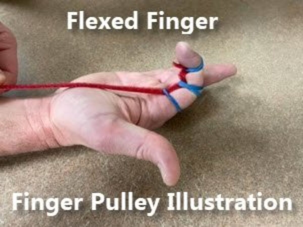 Finger Diagram Pulleys Pulley Injuries