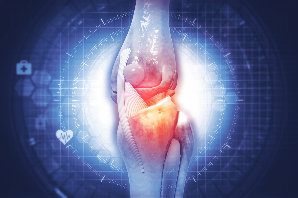 What is the recovery time for a MCL Tear? - JOI Jacksonville ...